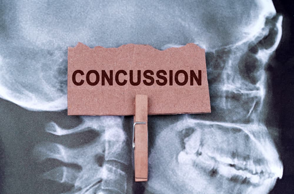 What's a good concussion car accident settlement amount? | Allen and Allen